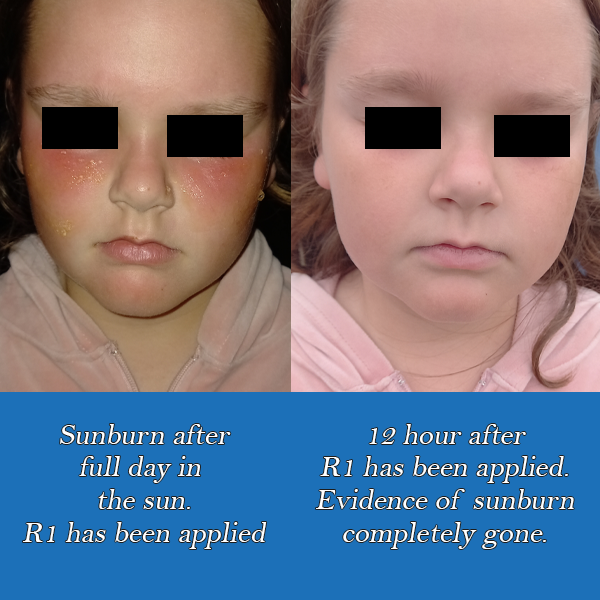 Aftersun - Radiaderm.co.za