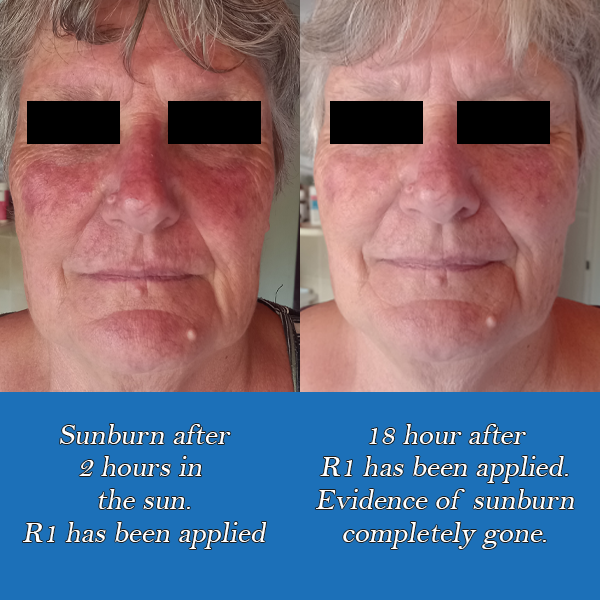 Aftersun - Radiaderm.co.za